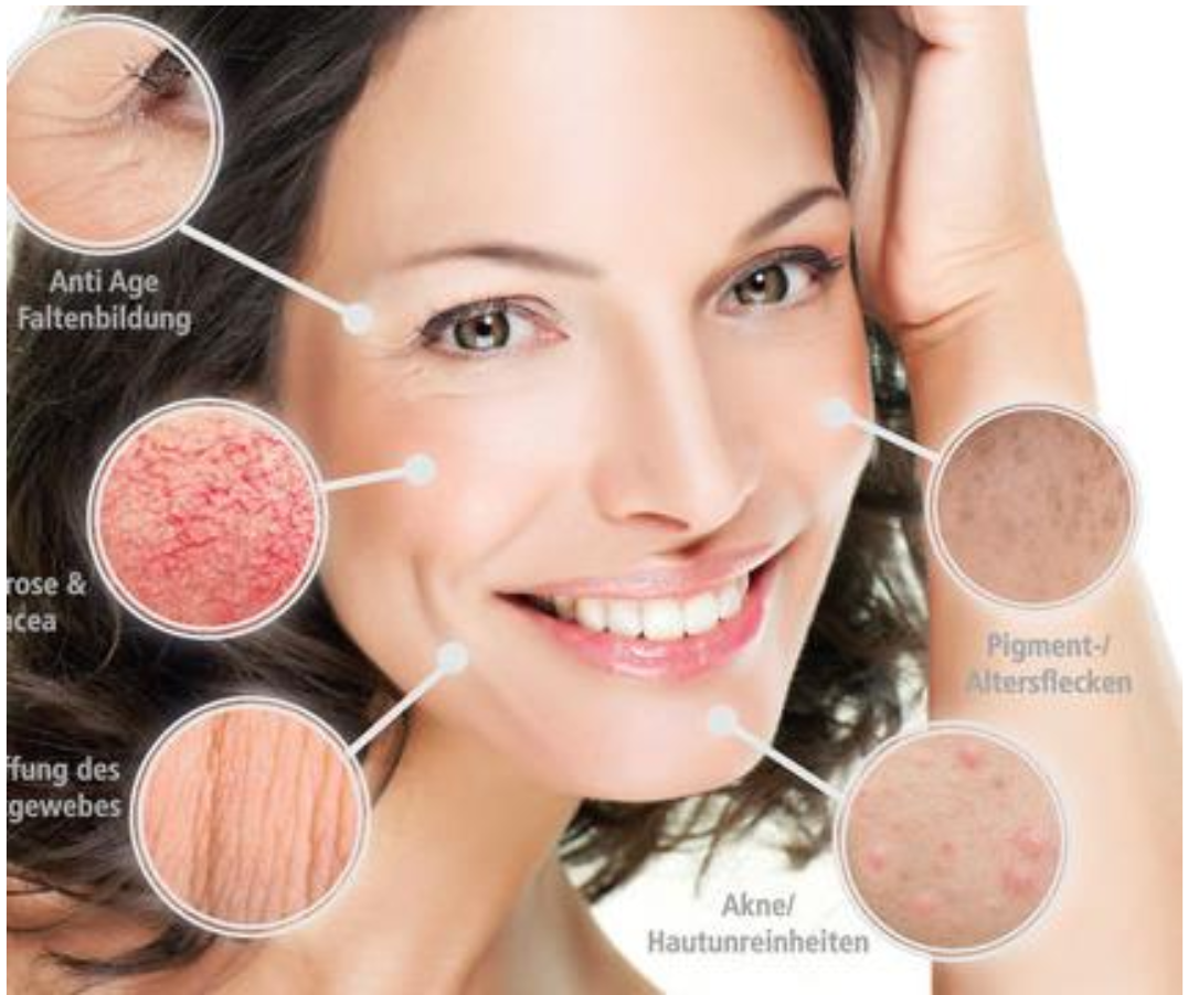 Bianca´s Kosmetikstudio - Microneedling